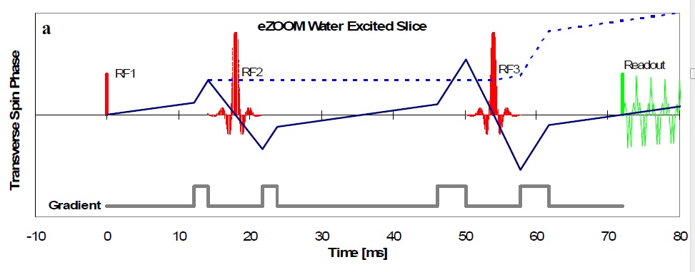 Oil/Water Phantom — MATLAB Number ONE