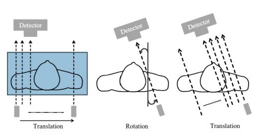 Generation of CT(Computed Tomography) scanners — MATLAB Number ONE