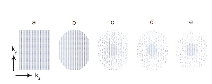 Accelerated 3D Imaging Using Compressed Sensing — MATLAB Number ONE