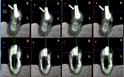 Measuring Defects on CBCT — MATLAB Number ONE