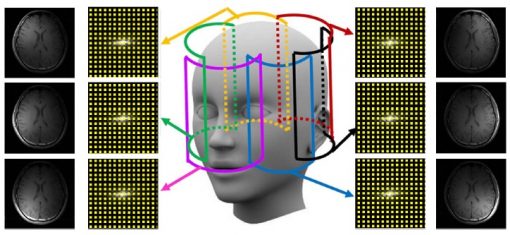 Parallel MRI — MATLAB Number ONE