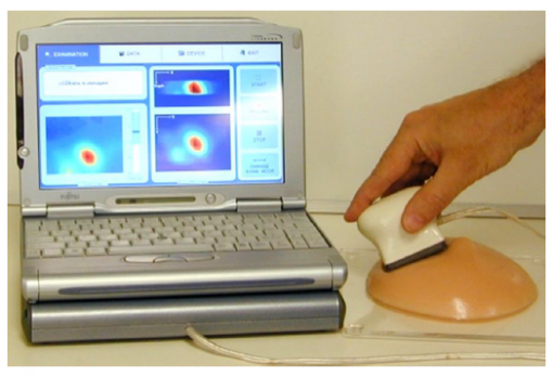 Background And Literature Review of Second Generation Tactile Imaging System For Mechanical ...