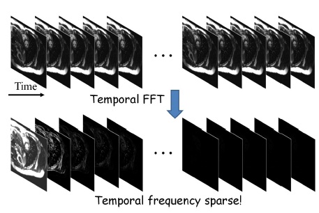 Compressed Sensing MRI — MATLAB Number ONE