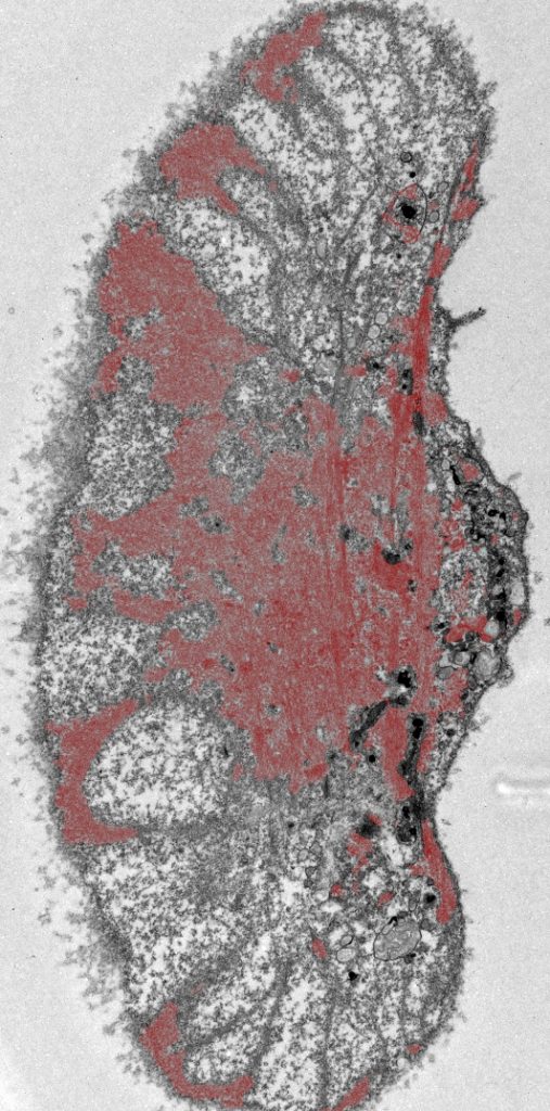 Local Spectral Histogram Segmentation Algorithm 1708